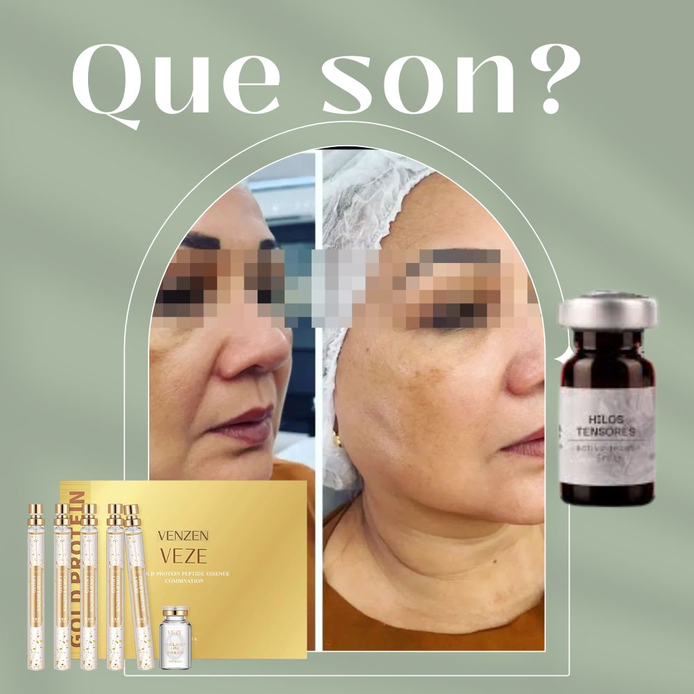 Master Class de Hilos Tensores Líquidos, nano botox, BB botox con ...